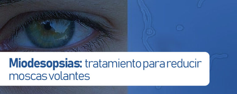 Miodesopsias: Tratamiento para Reducir Manchas en la Visión